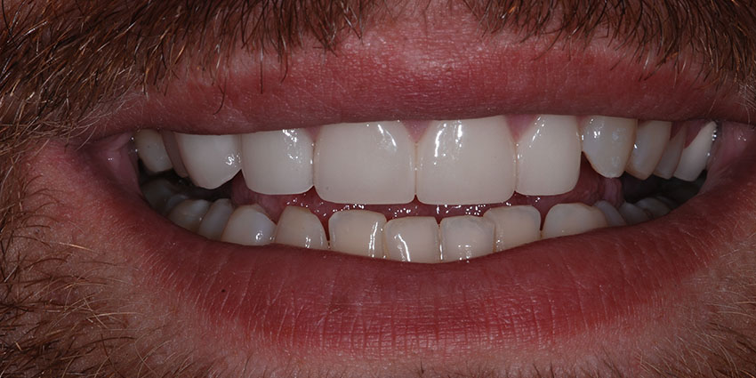 Smile Gallery | Legacy Dental of Carrollton