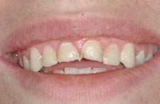 Our Patients | Legacy Dental of Carrollton